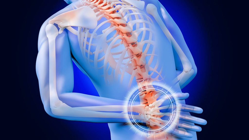 Todo sobre la hernia discal - WomanTime Vida saludable